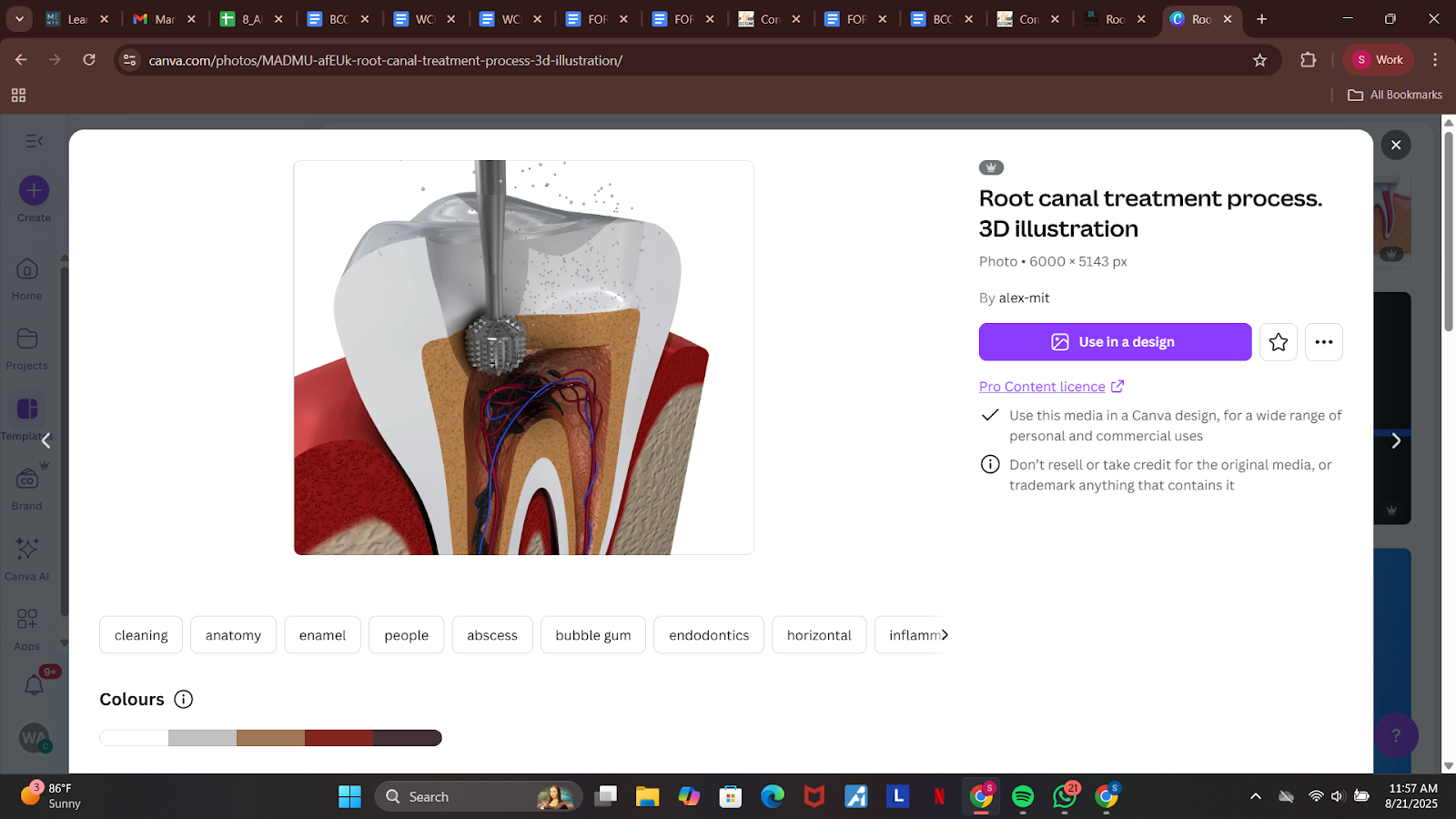 Do You Need A Root Canal After A Filling?
